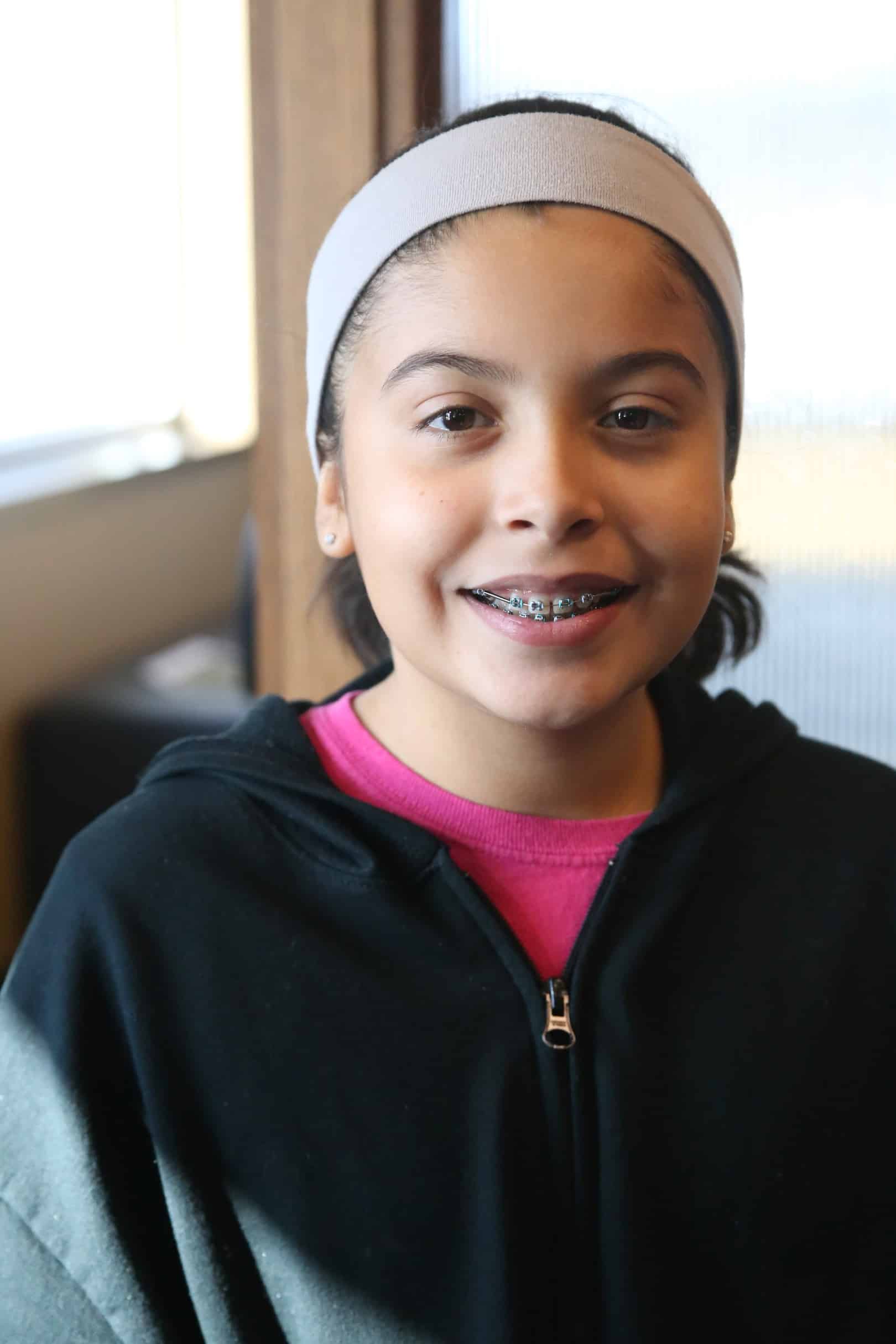 First Braces In History at Fred Rollins blog