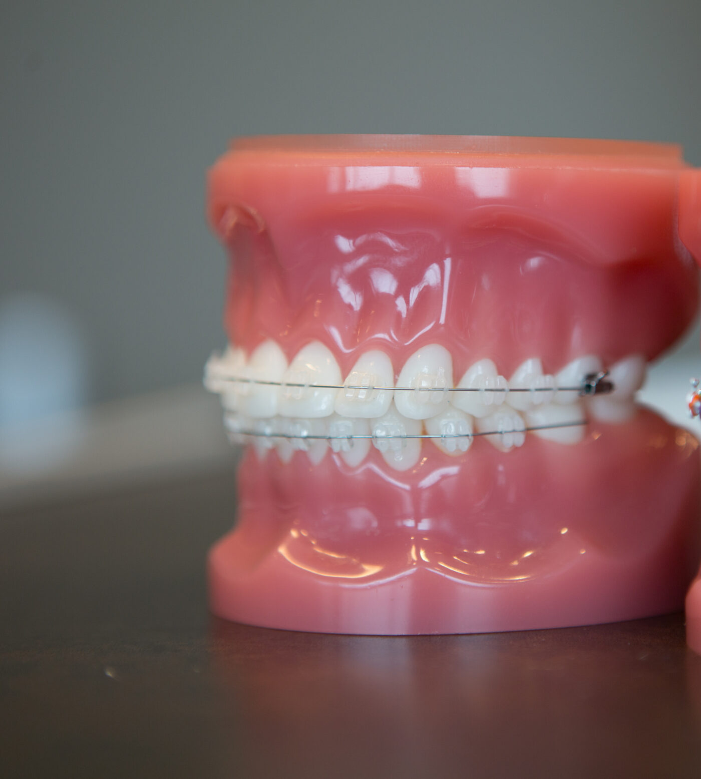 Clear Braces in Olathe & Overland Park, KS